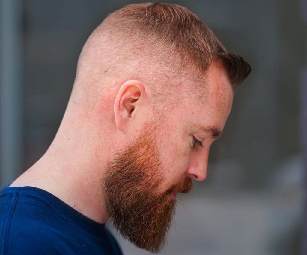 Best Haircut For Receding Hairline And Thinning Hair - Your Holiday ...